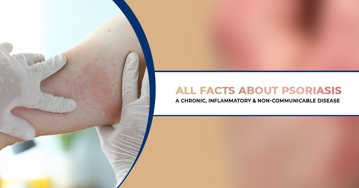 All Facts about Psoriasis: A Chronic, Inflammatory and Non-communicable ...